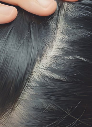 Perimenopausal hair thinning: What to know